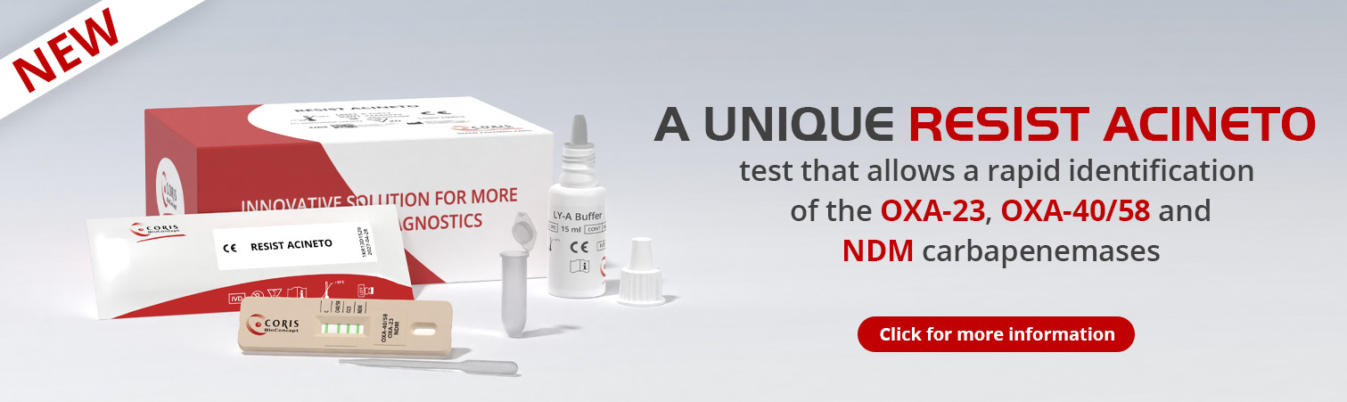 Rapid diagnostic tests, antigen detection, IVD technology